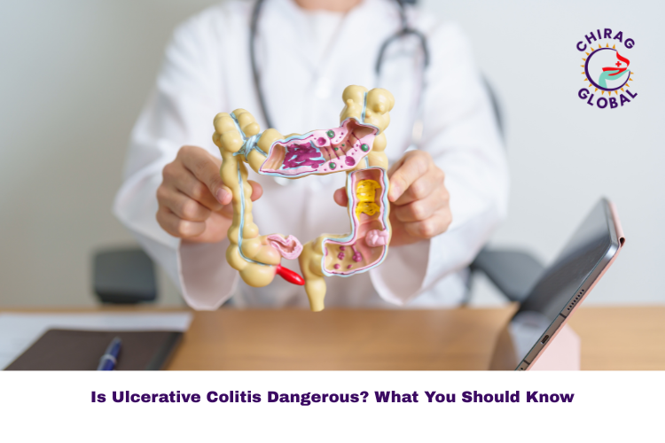 Is Ulcerative Colitis Dangerous? | Expert Care in Bangalore