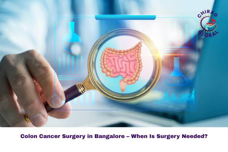 Colon Cancer Surgery in Bangalore | When Is Surgery Needed?
